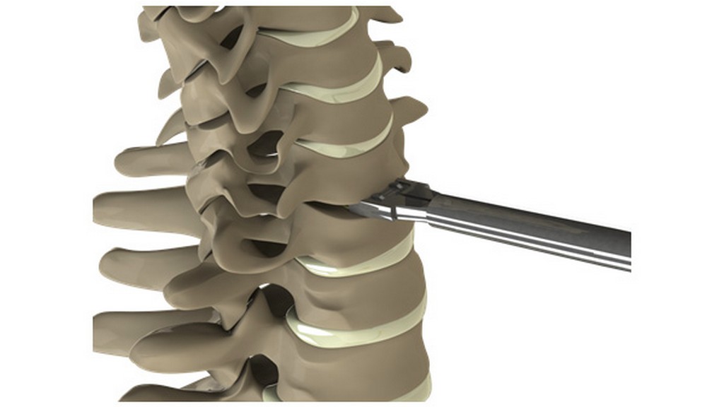 Métodos de prueba estándar ASTM F2706-18 para construcciones de ...
