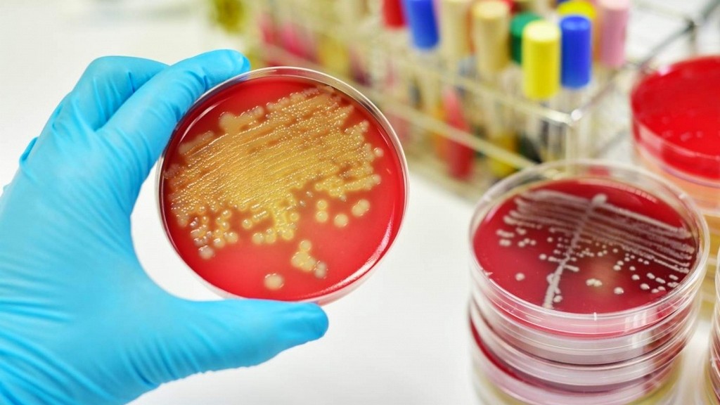 FDA Bacteriological Analytical Manual (BAM) Analyses