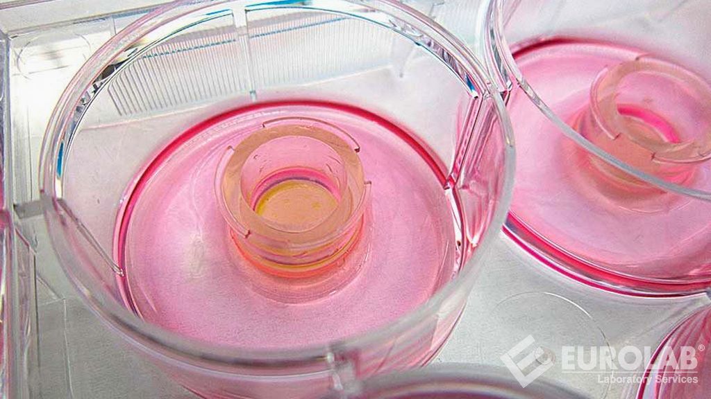 Prueba de glóbulos rojos in vitro