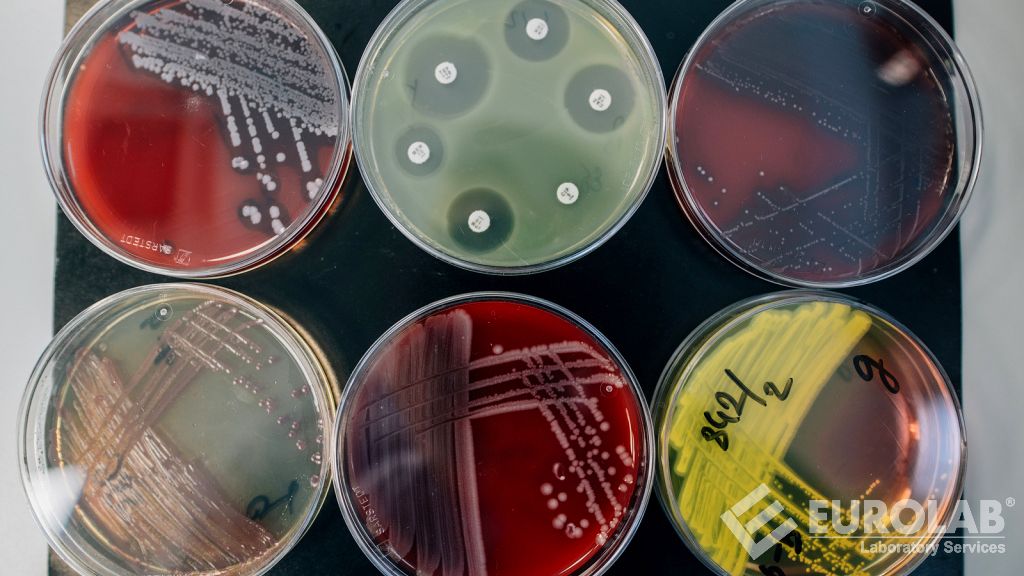 ISO 11930 Cosmetics - Microbiology - Evaluation of Antimicrobial ...