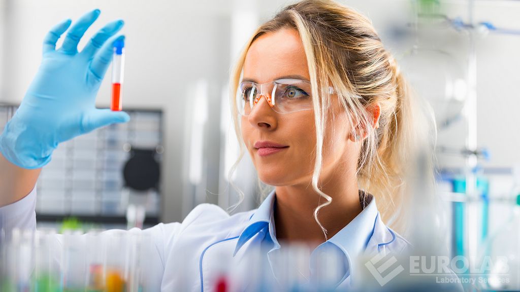 Testes de Qualidade - Determinação do Número Reichert-Meissl