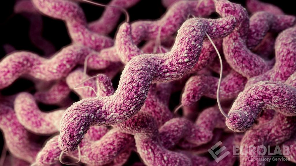 Nā Ho'āʻo Microbiological - Huli i nā ʻano ʻano Campylobacter pale wela ...